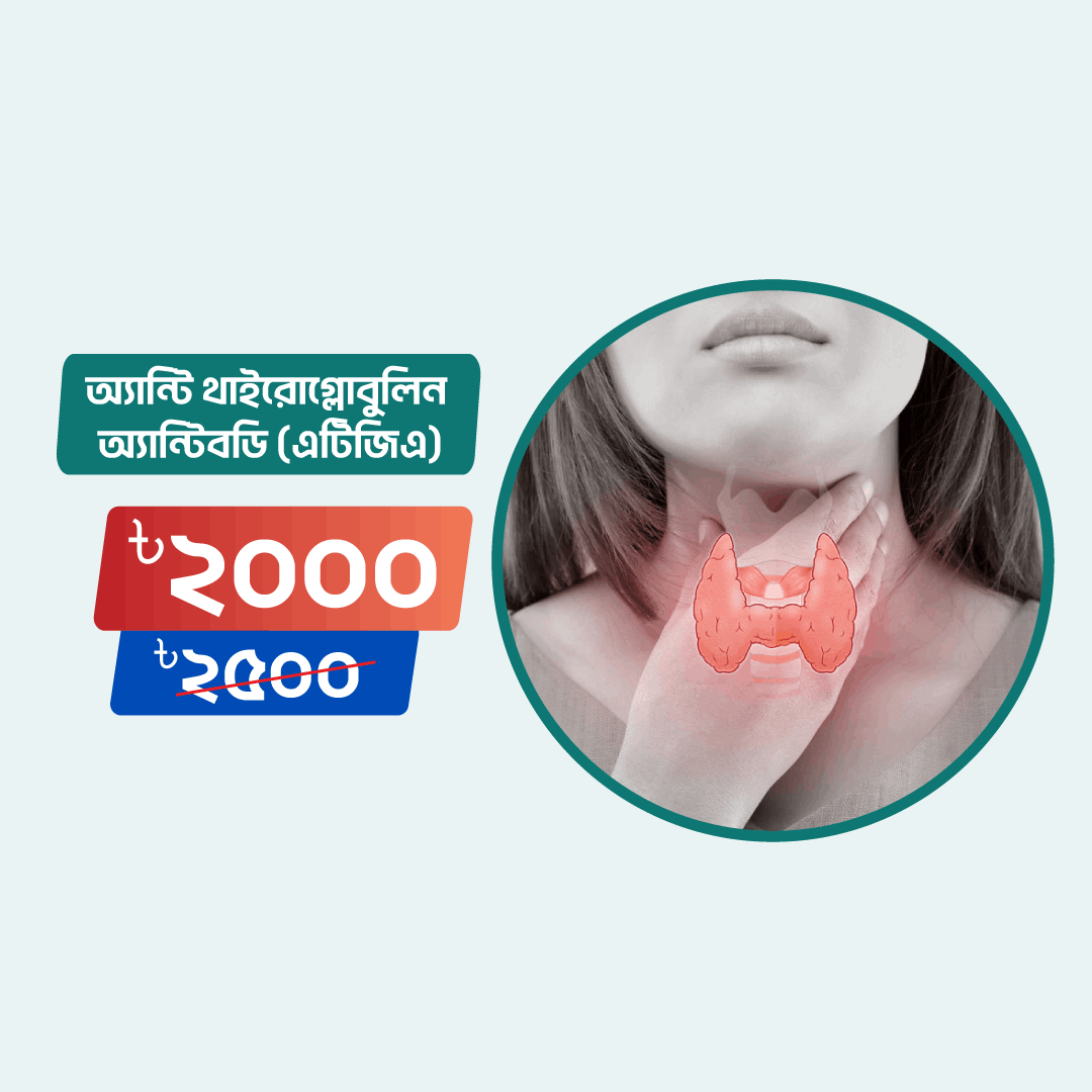 Anti Thyroglobulin Antibody (ATGA) test Online in Dhaka | Arogga Online Lab