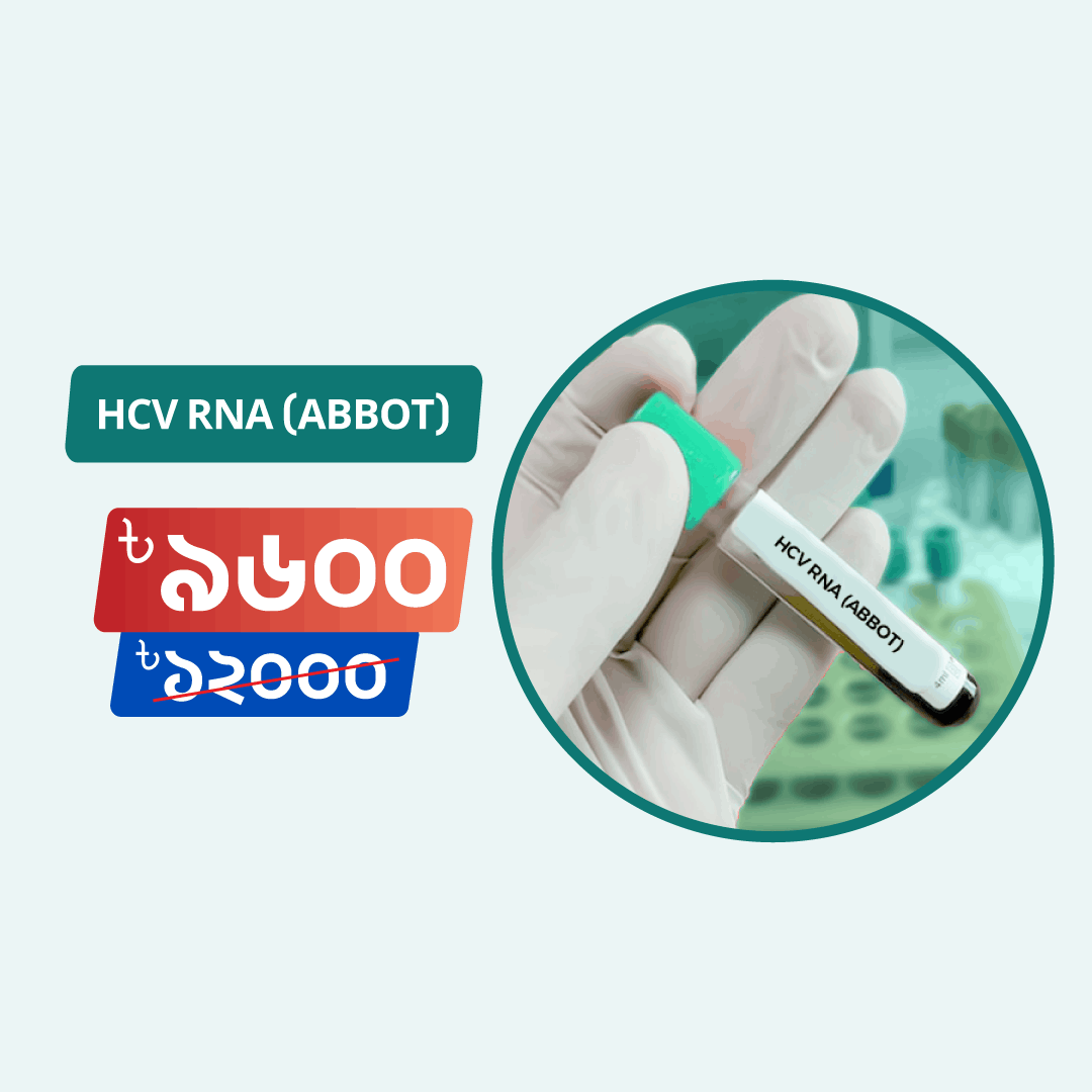 Hcv Rna (Abbot) test Online in Dhaka | Arogga Online Lab