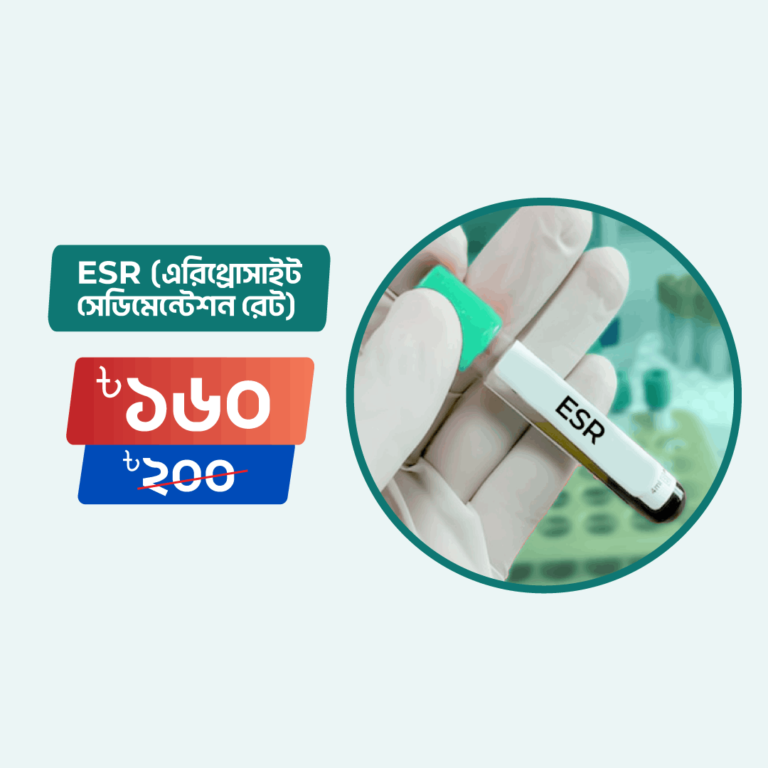 ESR (Erythrocyte Sedimentation Rate) - Arogga Online Lab