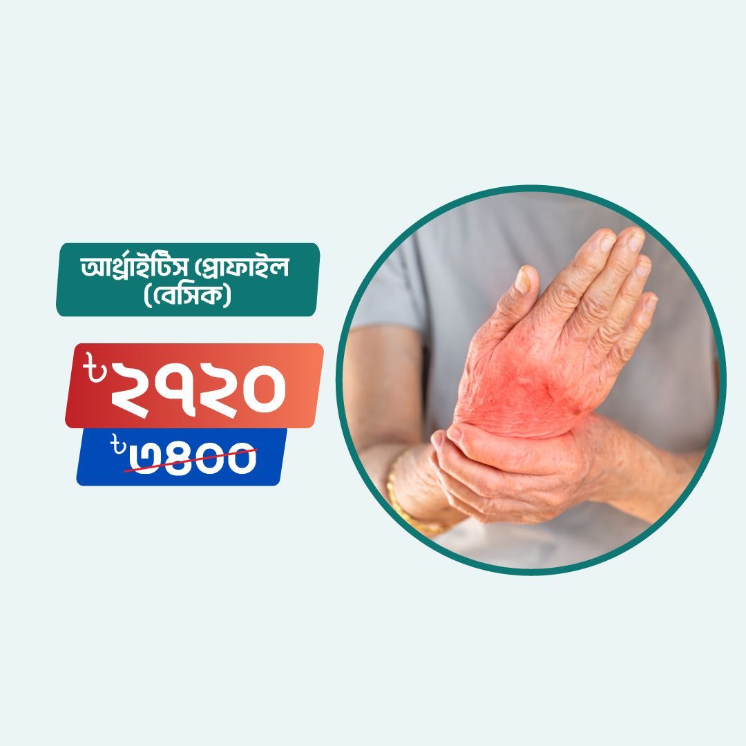 Arthritis Profile (BASIC) - Arogga Online Lab