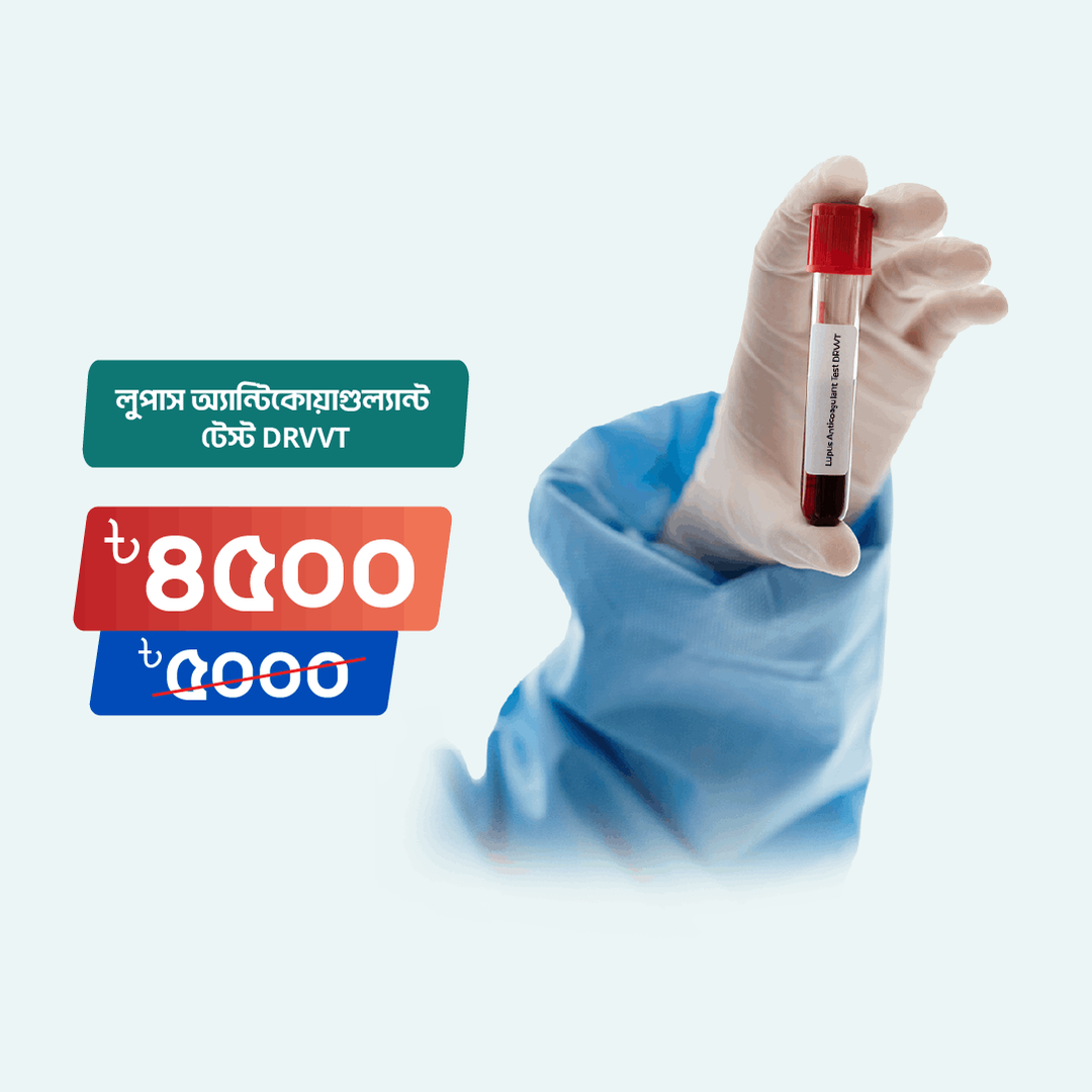 Lupus Anticoagulant Test DRVVT - Arogga Online Lab