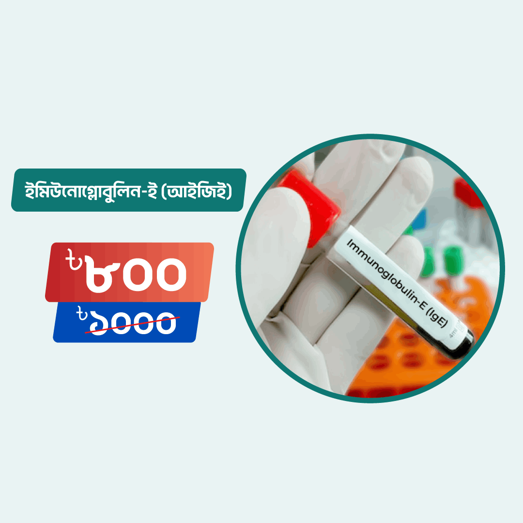 Immunoglobulin-E (IgE) - Arogga Online Lab