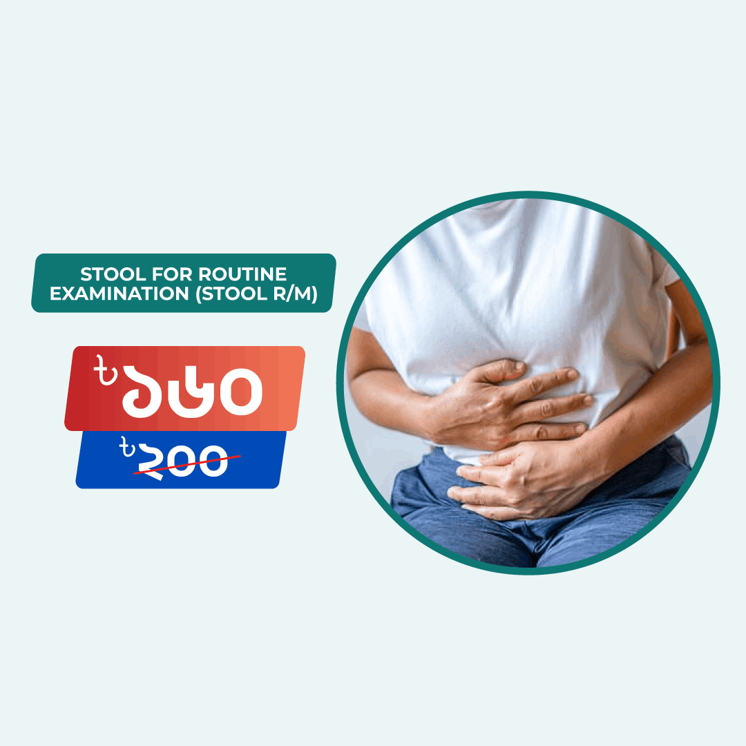 STOOL FOR ROUTINE EXAMINATION (Stool R/M) - Arogga Online Lab