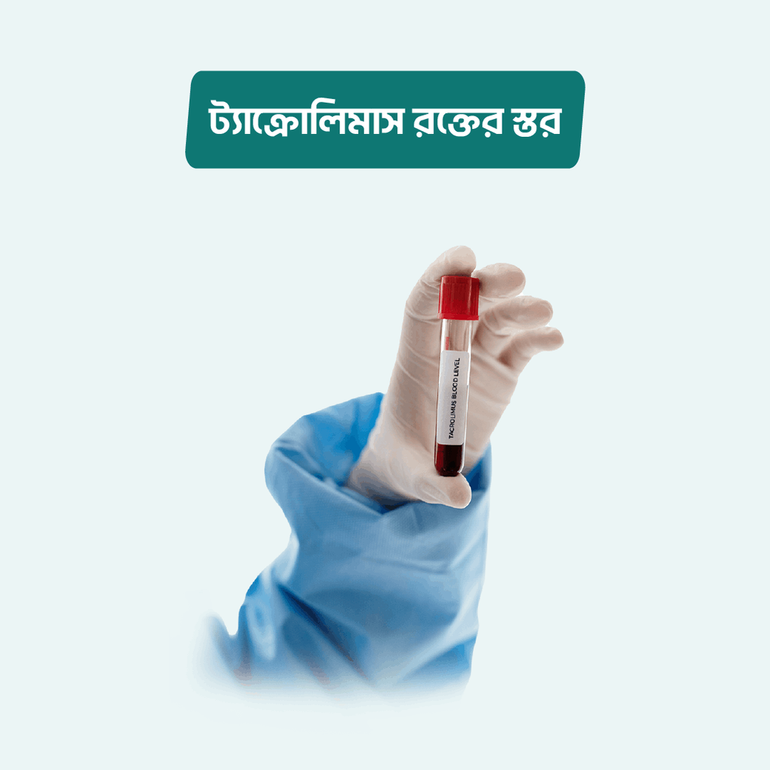 Tacrolimus Blood Level - Arogga Online Lab