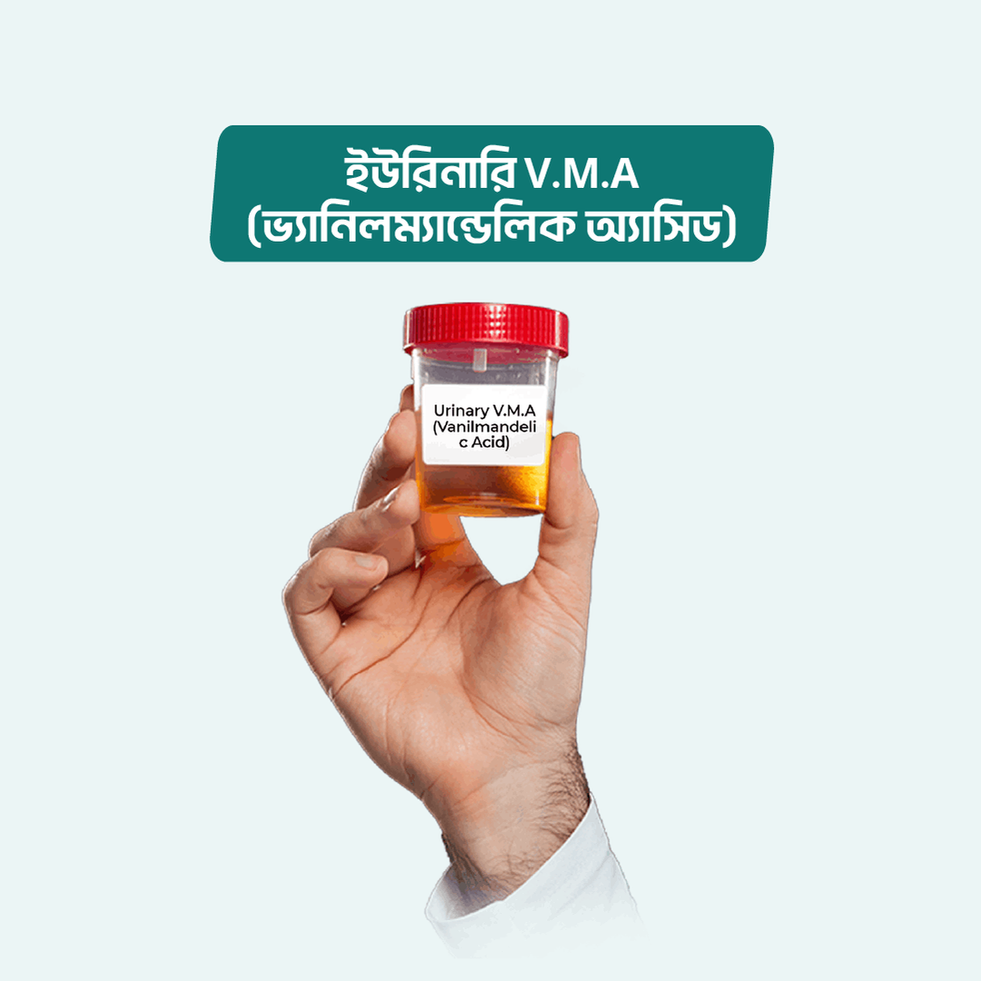 Urinary V.M.A (Vanilmandelic Acid) - Arogga Online Lab