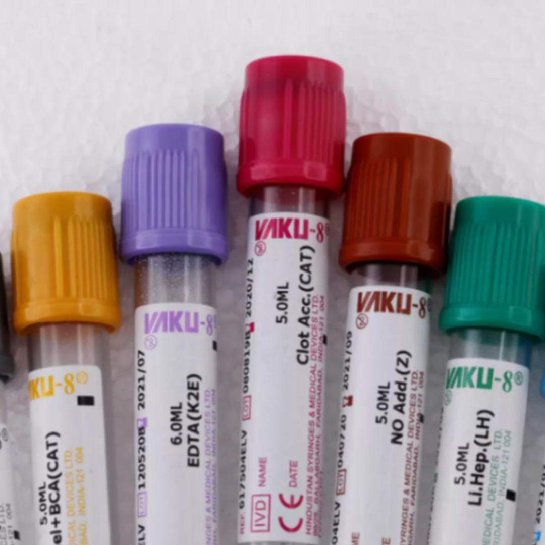 Bicarbonate (HCO3) - Arogga Online Lab