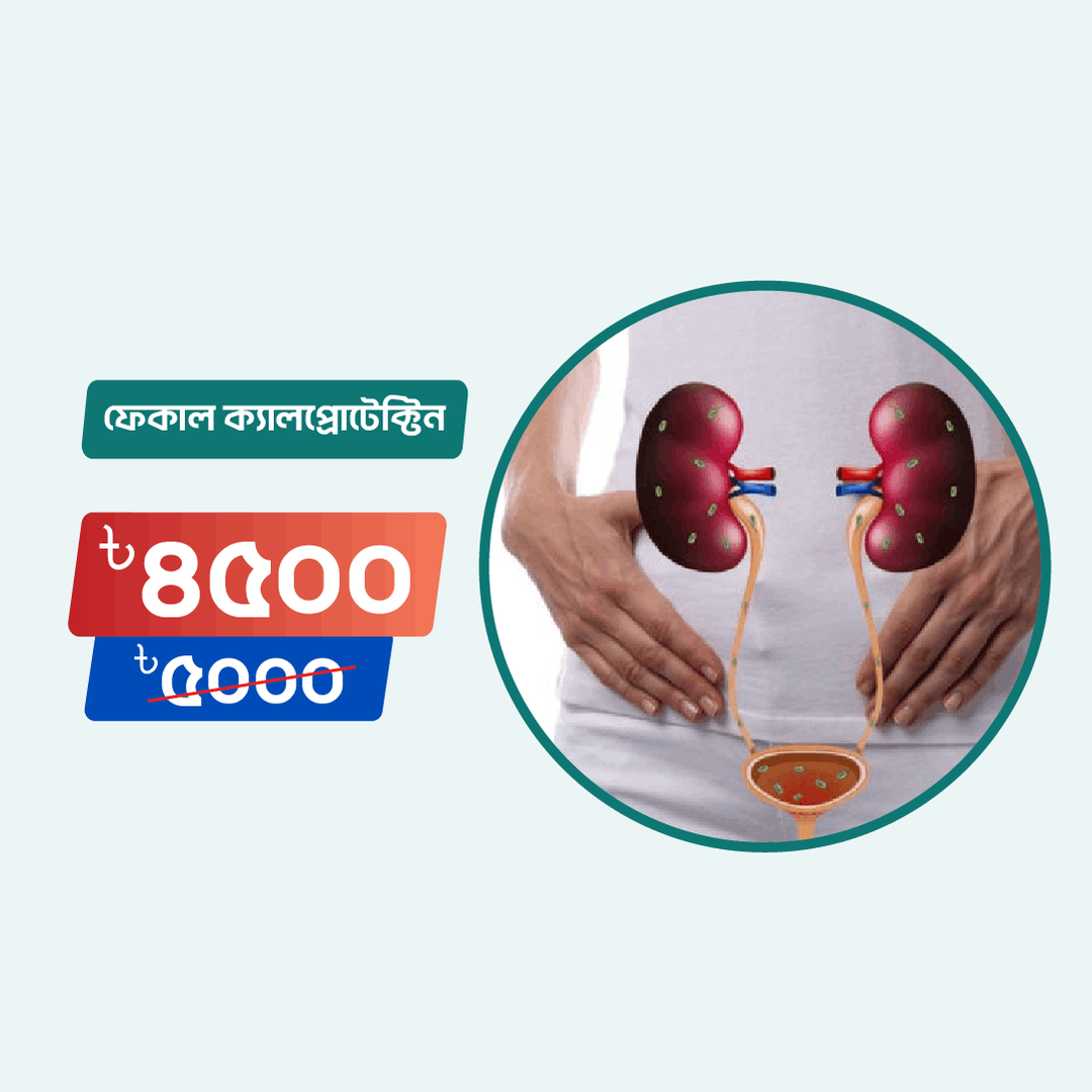 Fecal Calprotectin - Arogga Online Lab