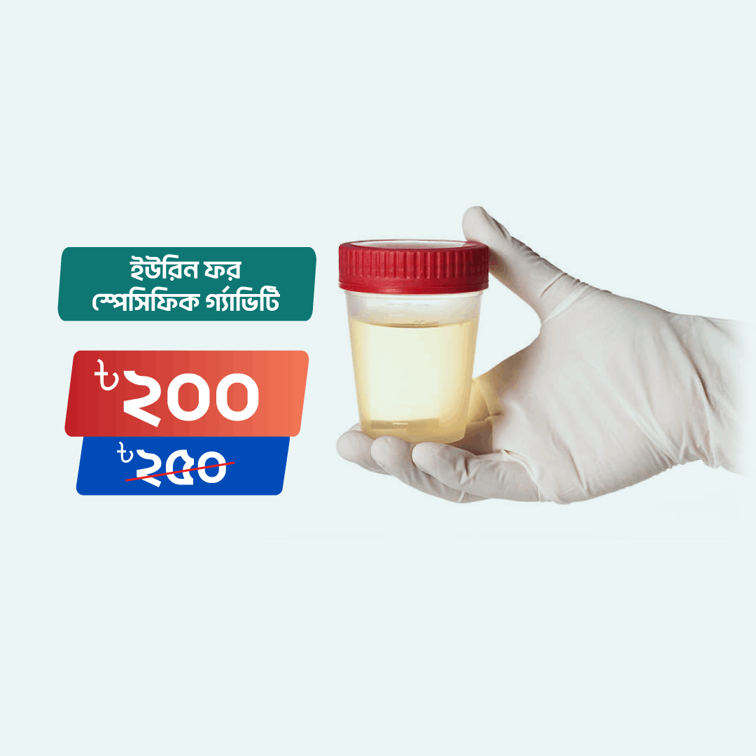 Urine For Specific Gravity Arogga Online Lab 2889