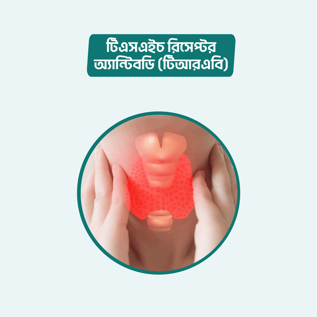 TSH receptor antibodies (TRAb) - Arogga Online Lab