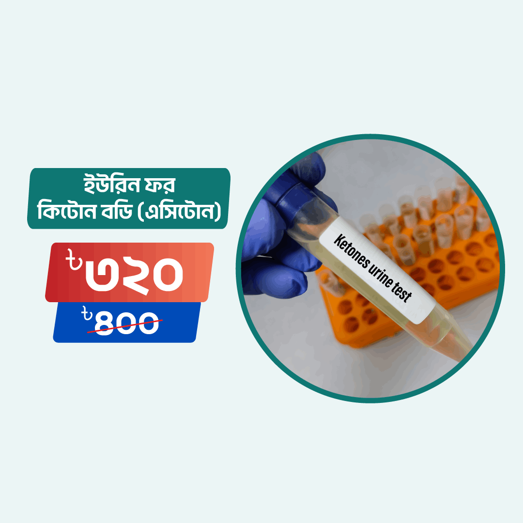 Urine Ketone Body (Acetone) - Arogga Online Lab