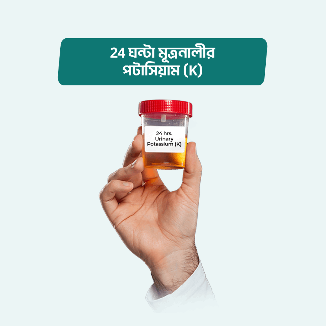 24 hrs. Urinary Potassium (K) test Online in Dhaka | Arogga Online Lab