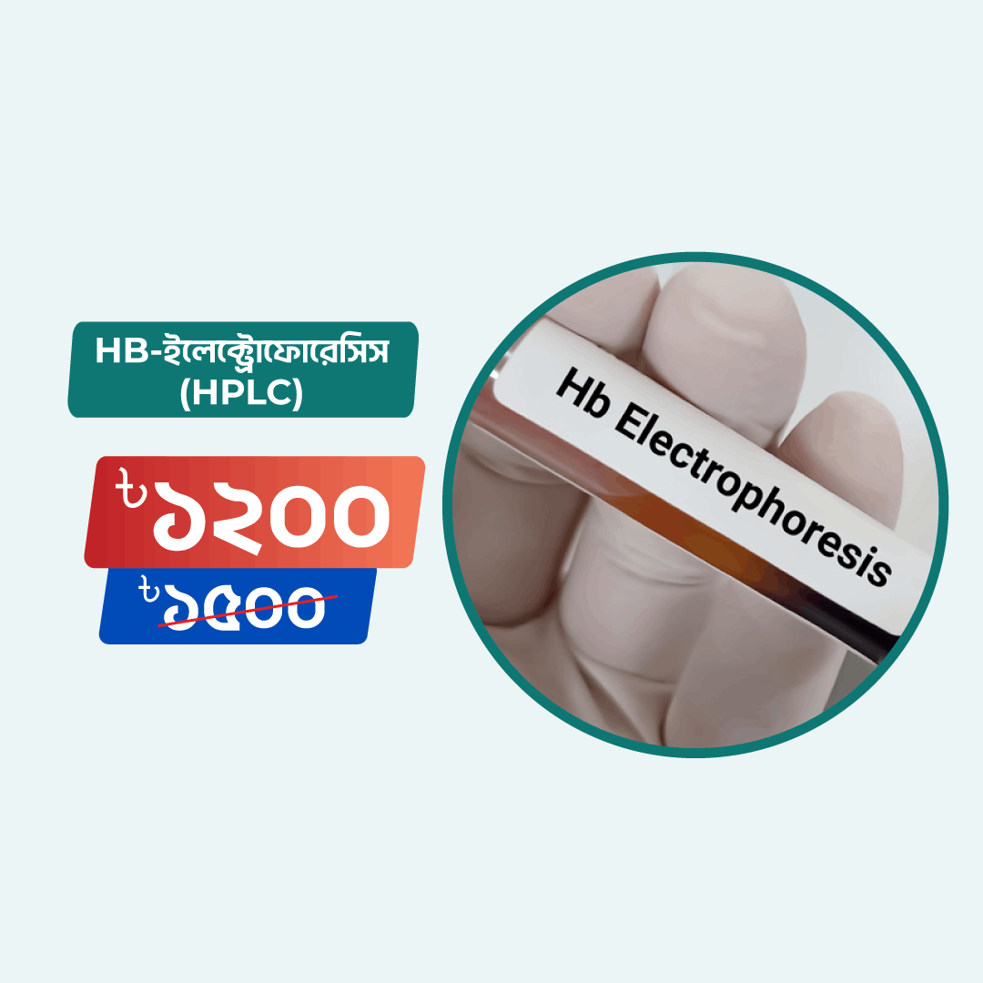HB-Electrophoresis (HPLC) test Online in Dhaka | Arogga Online Lab
