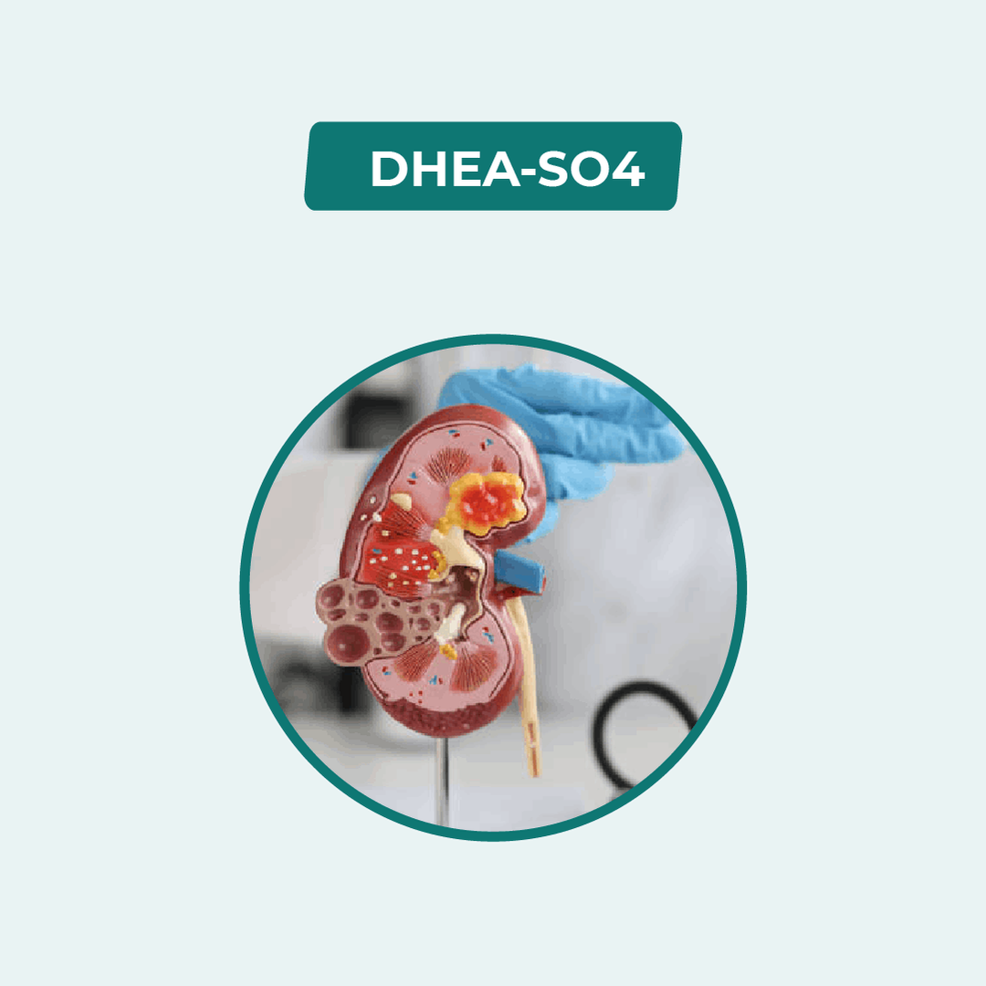 DHEA - SO4 - Arogga Online Lab