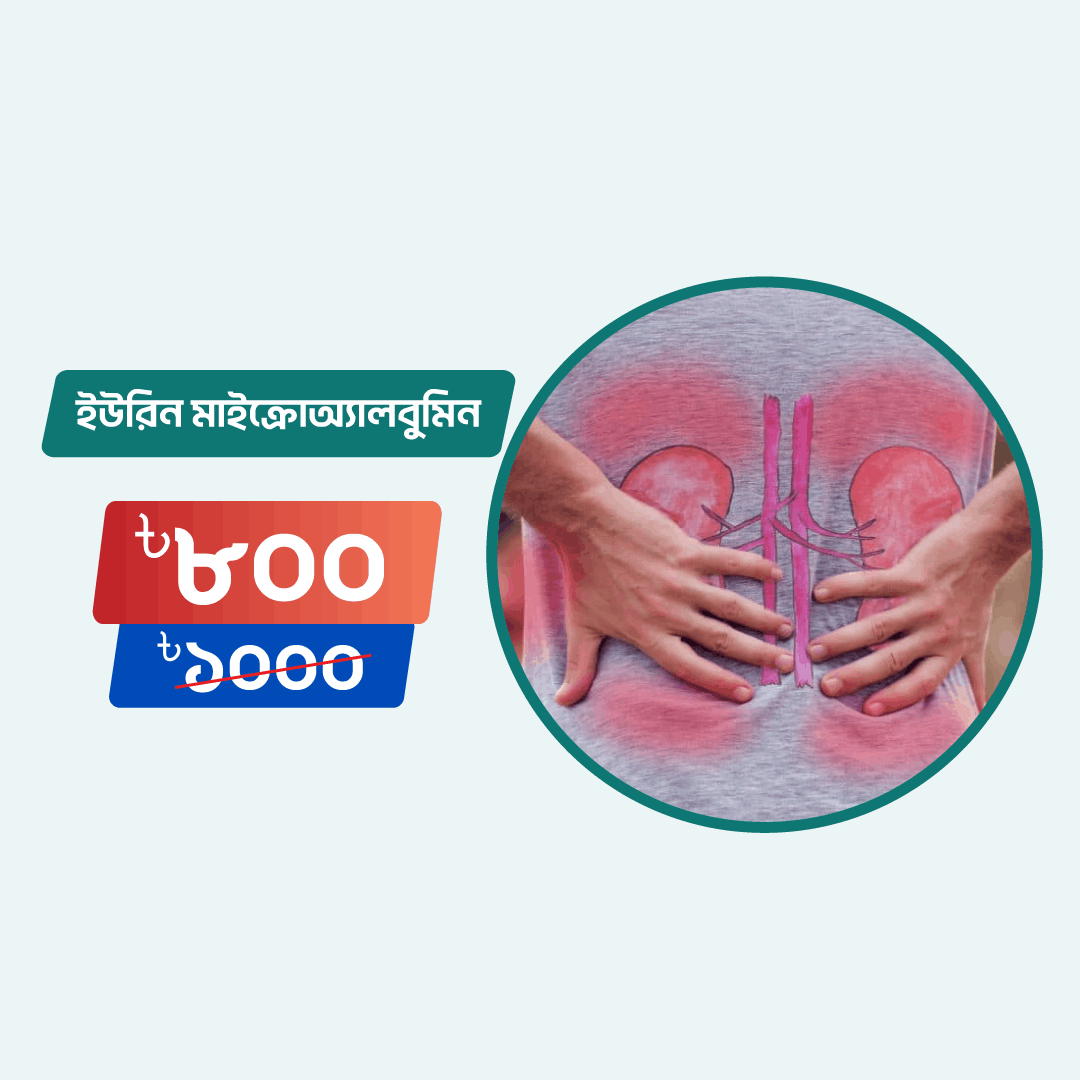 Urine Microalbumin - Arogga Online Lab