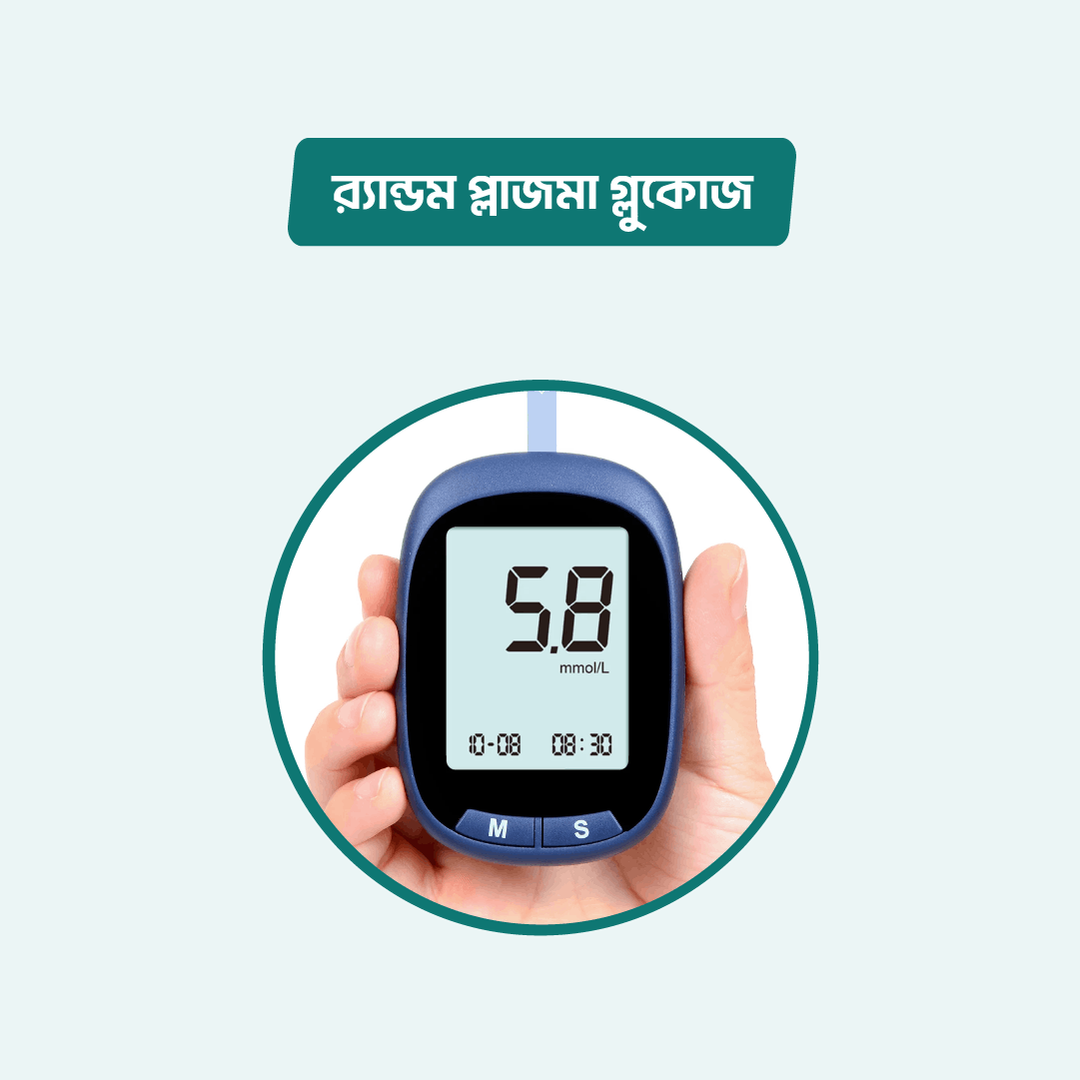 Random Plasma glucose (RBS) - Arogga Online Lab