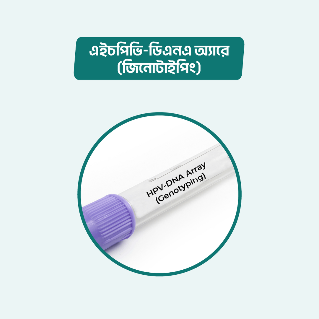 HPV-DNA Array (Genotyping) - Arogga Online Lab