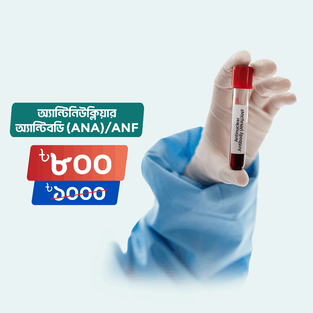 Antinuclear Antibody (ANA)/ANF - Arogga Online Lab