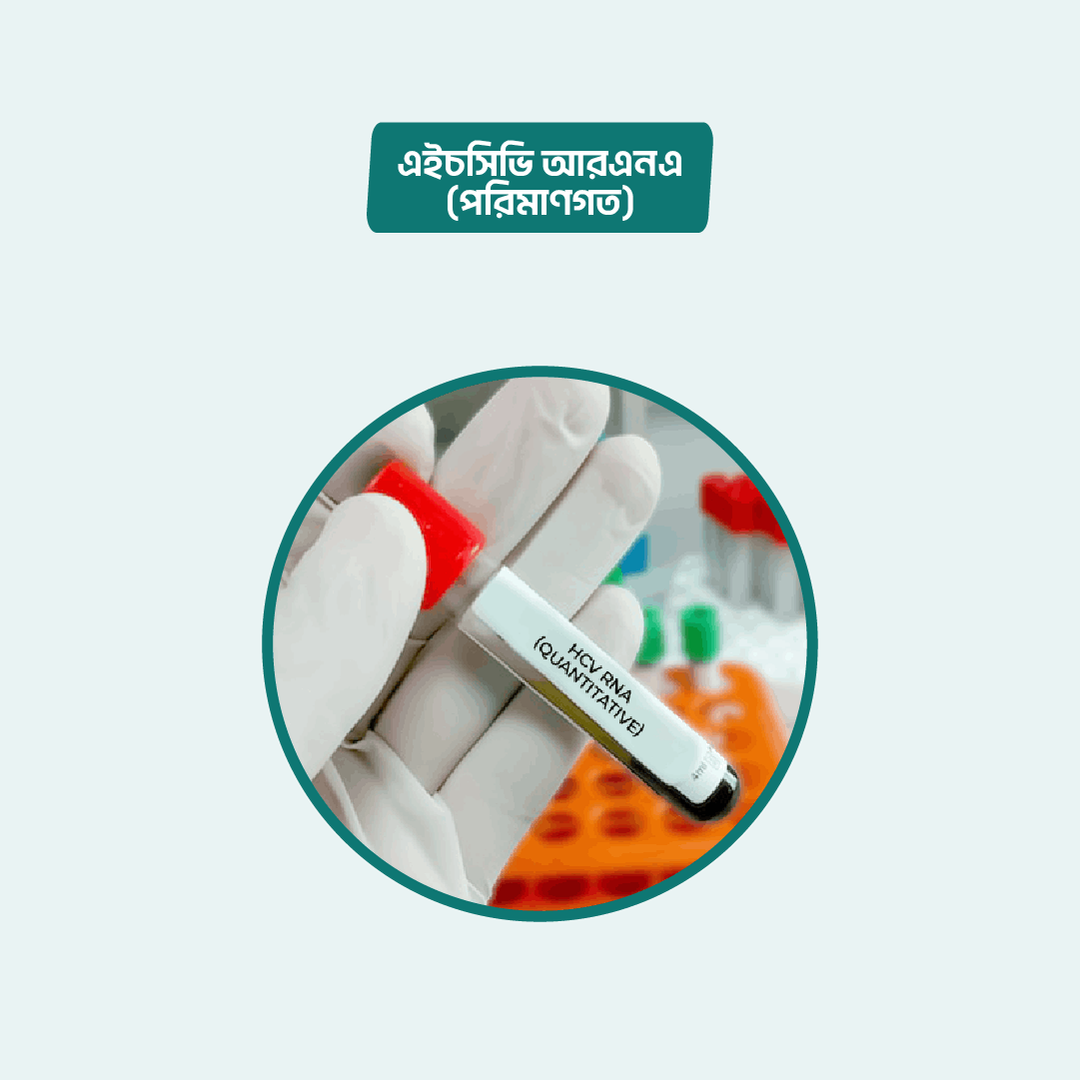 HCV-RNA (Qn.) PCR test Online in Dhaka | Arogga Online Lab