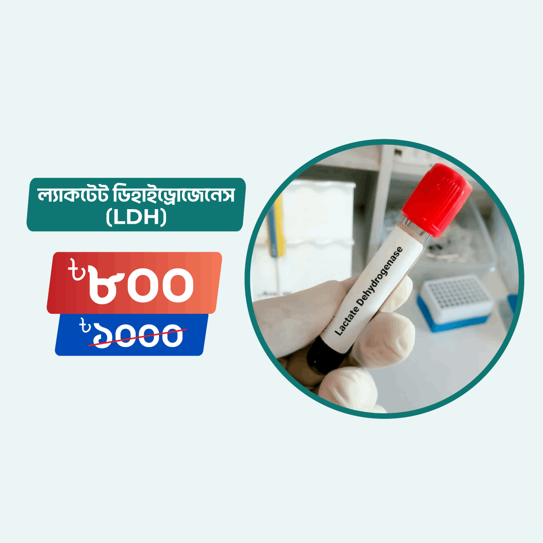 Lactate Dehydrogenase (LDH) - Arogga Online Lab