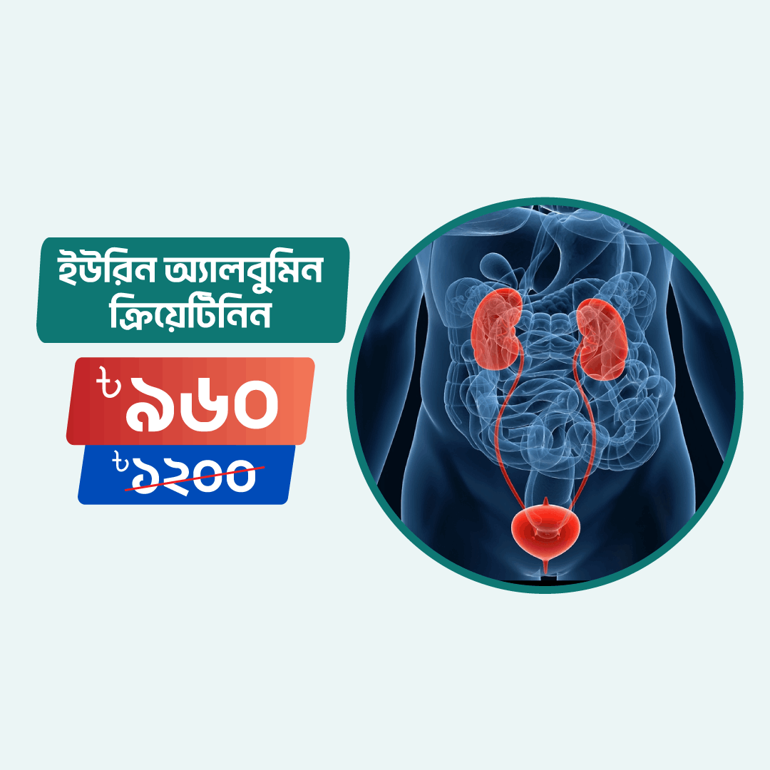 Urine Albumin Creatinine Ratio (ACR) - Arogga Online Lab