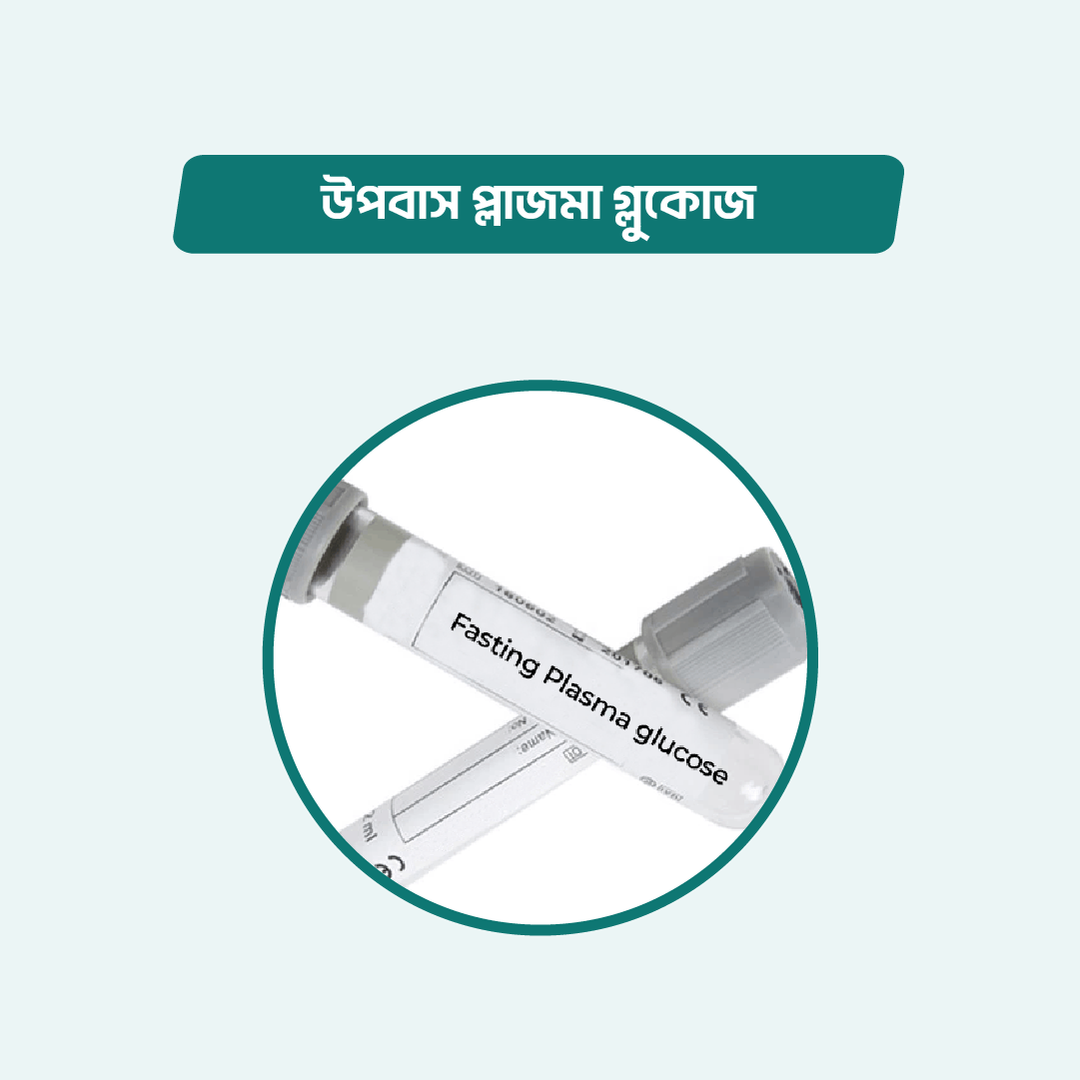 Fasting Plasma glucose (FBS) test Online in Dhaka | Arogga Online Lab