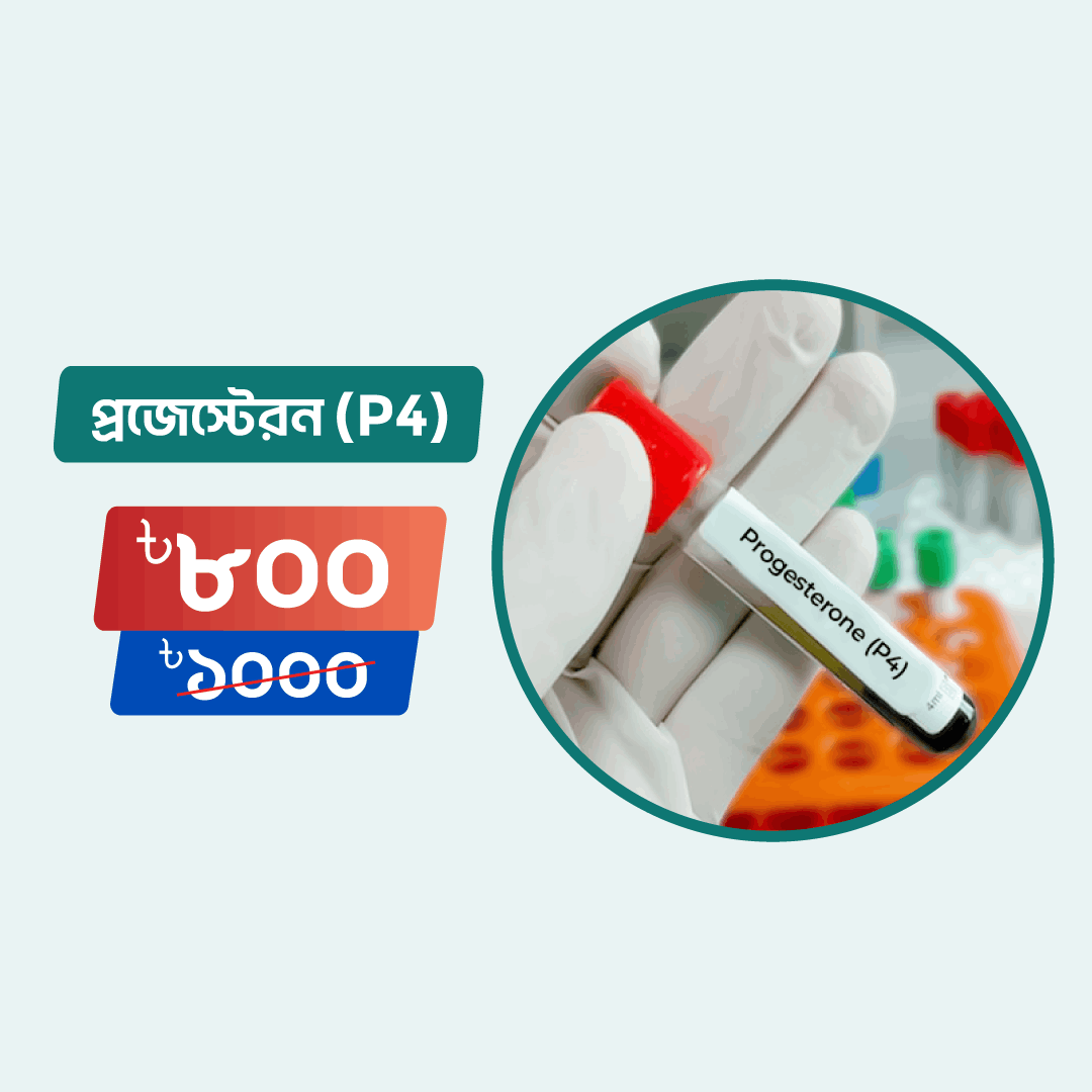 Progesterone (P4) test Online in Dhaka | Arogga Online Lab