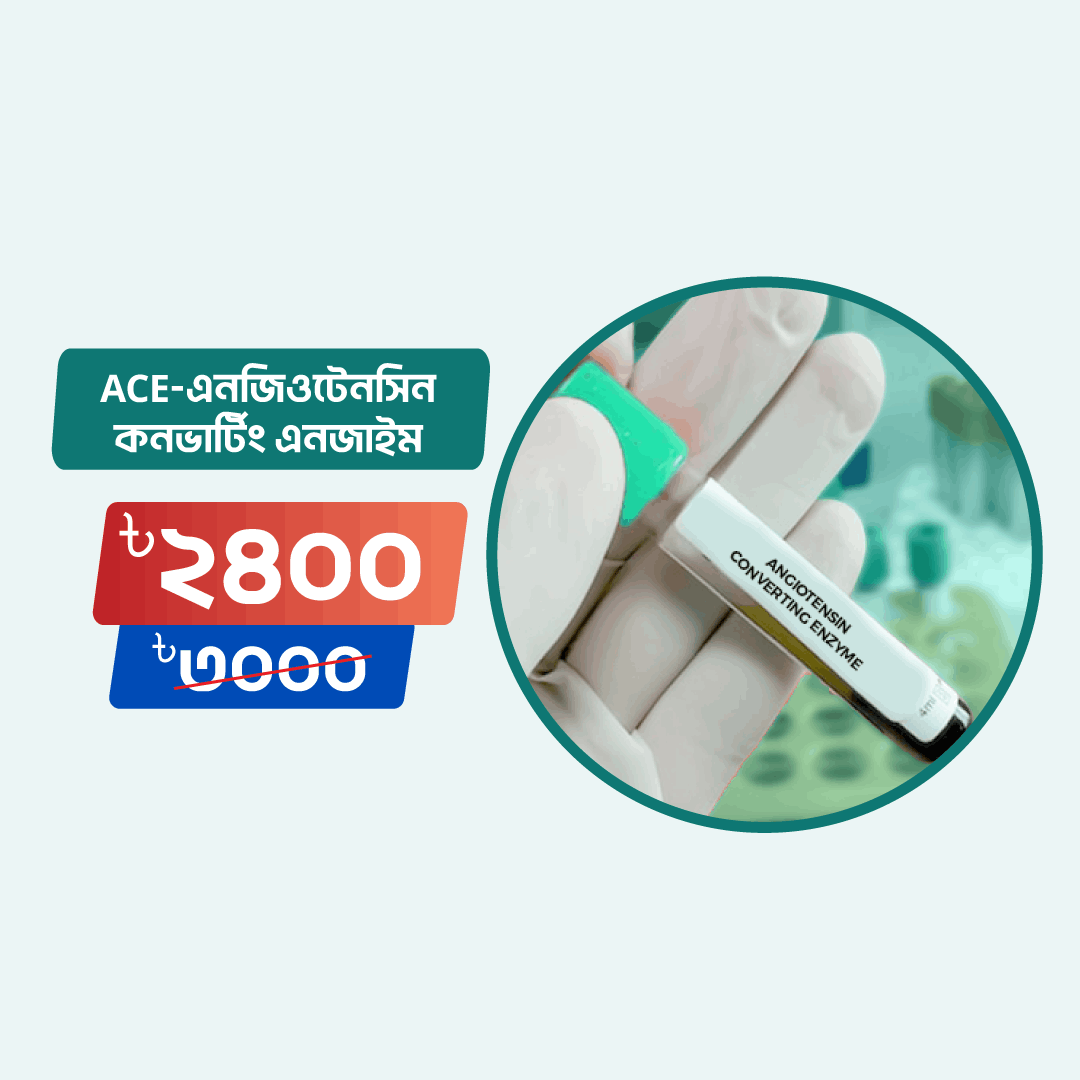 ACE-Angiotensin Converting Enzyme - Arogga Online Lab