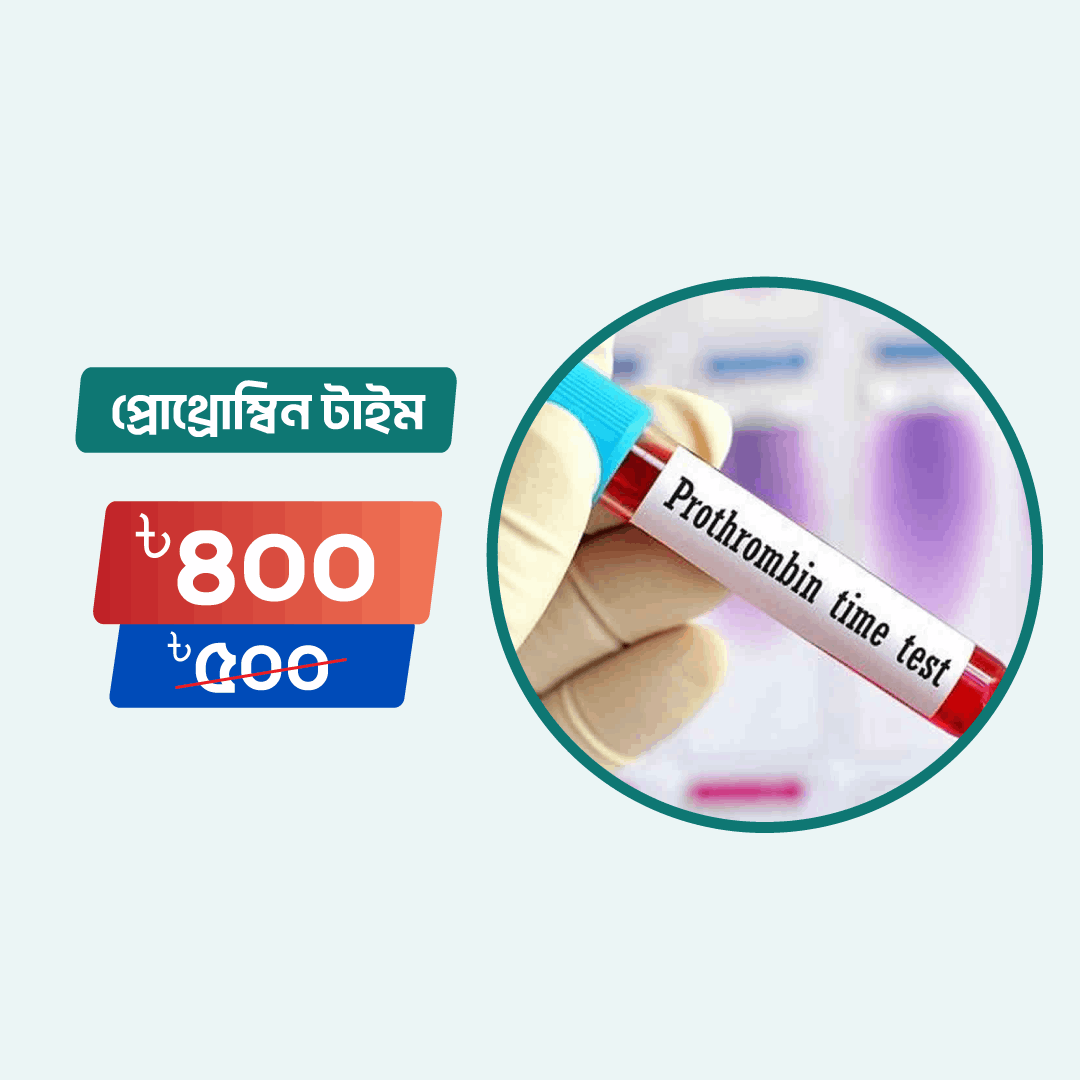 Prothrombin Time (PT) - Arogga Online Lab