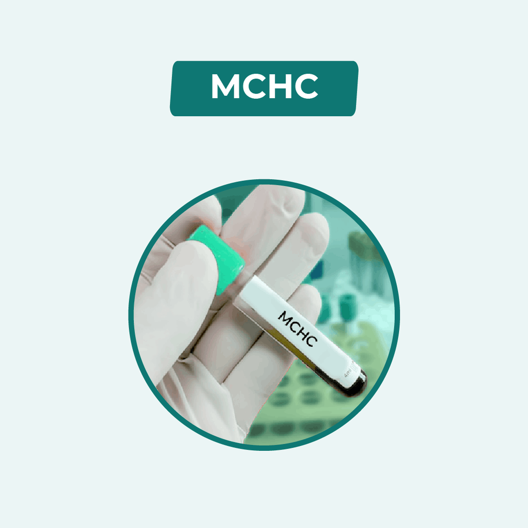MCHC test Online in Dhaka | Arogga Online Lab
