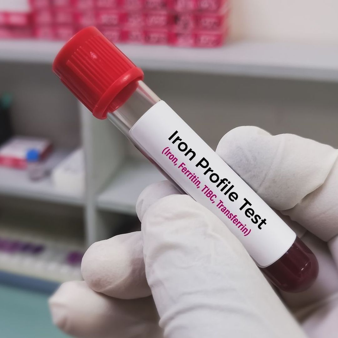 Iron Profile Test - Arogga Online Lab