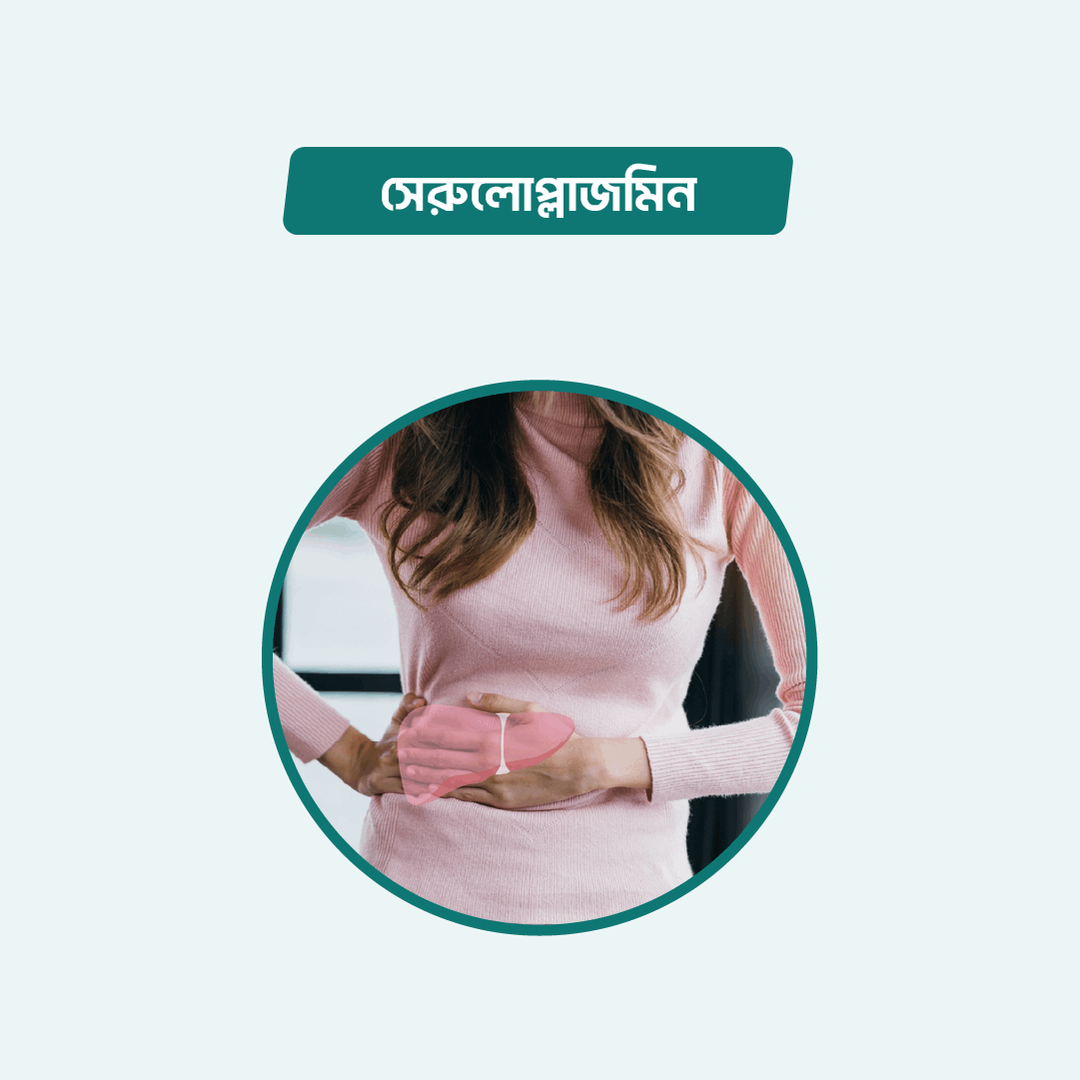 Ceruloplasmin (BLOOD CP) test Online in Dhaka | Arogga Online Lab