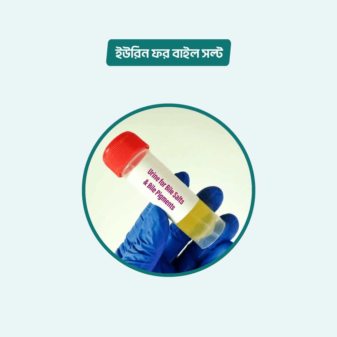 Urine for Bile Salts test Online in Dhaka | Arogga Online Lab