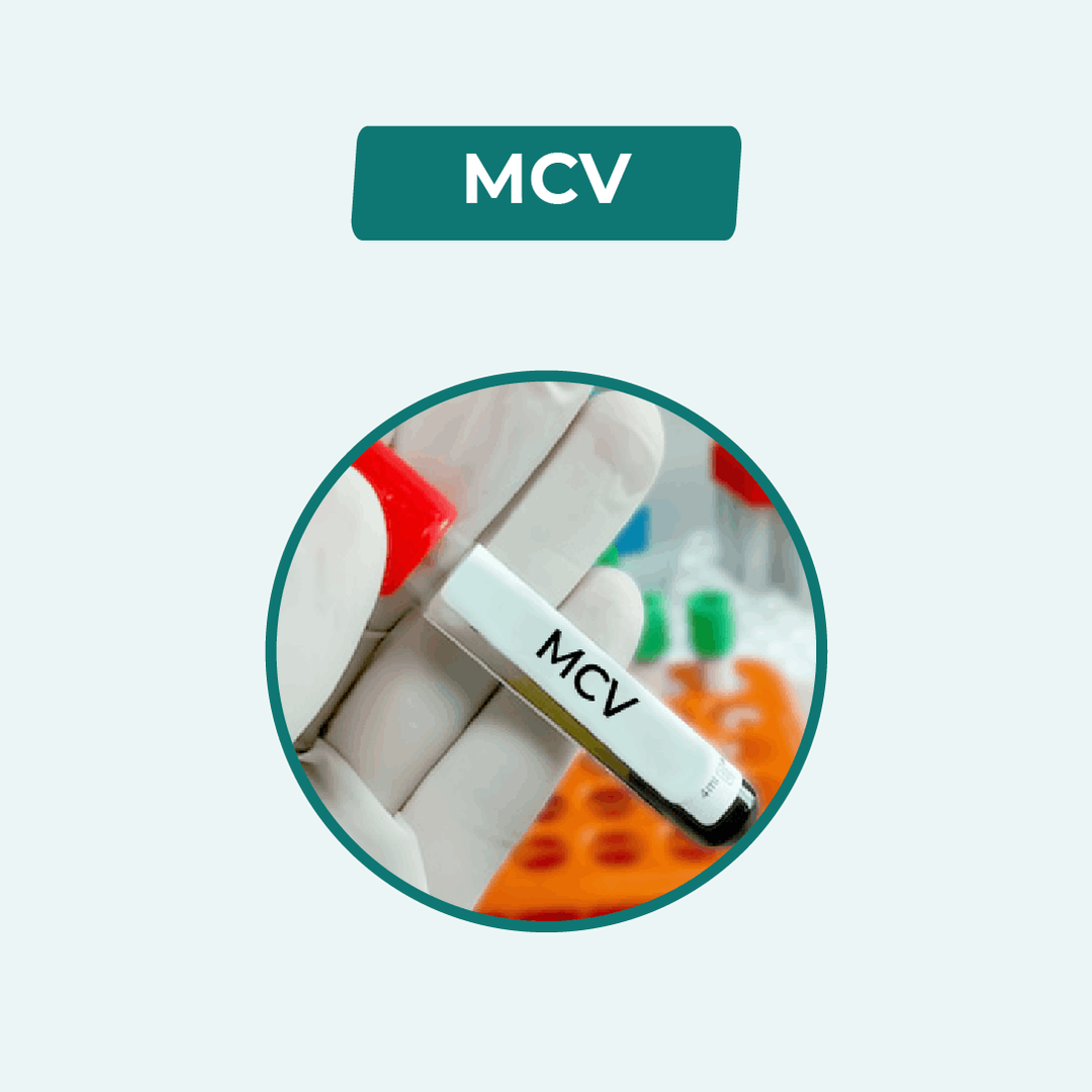 MCV test Online in Dhaka | Arogga Online Lab