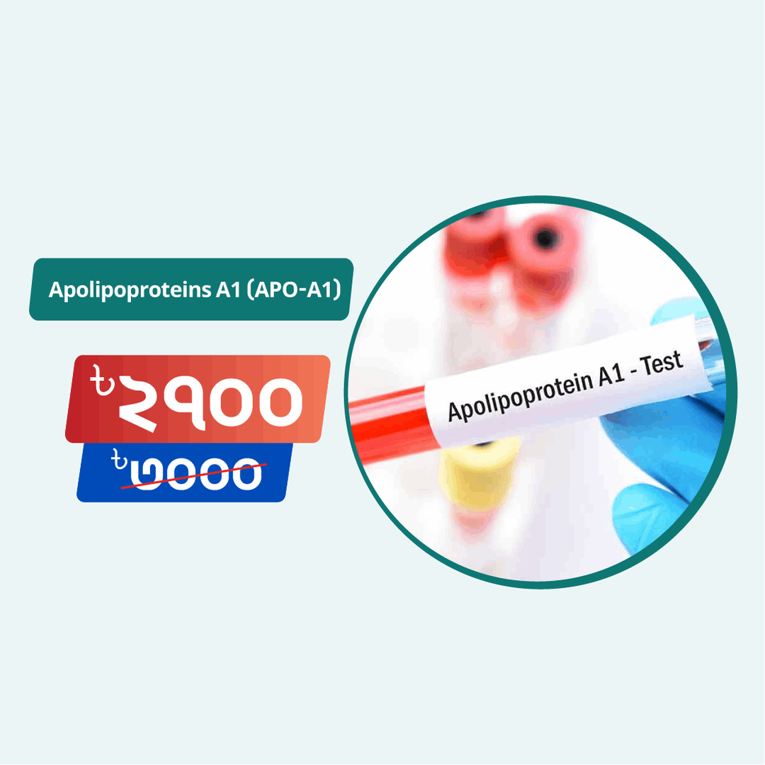 Apolipoproteins A1 (APO-A1) test Online in Dhaka | Arogga Online Lab