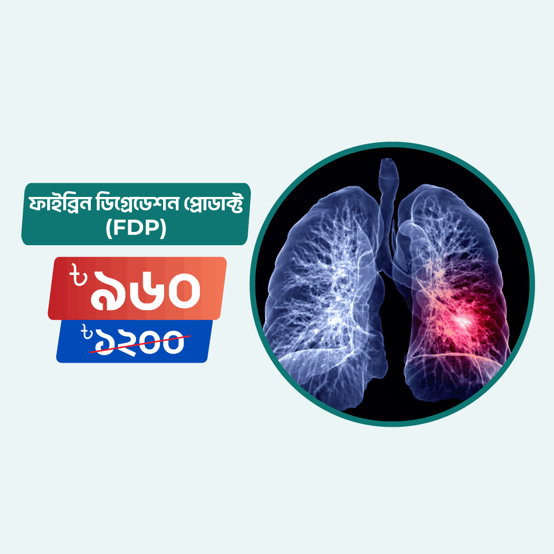 Fibrin Degradation Product (FDP) - Arogga Online Lab