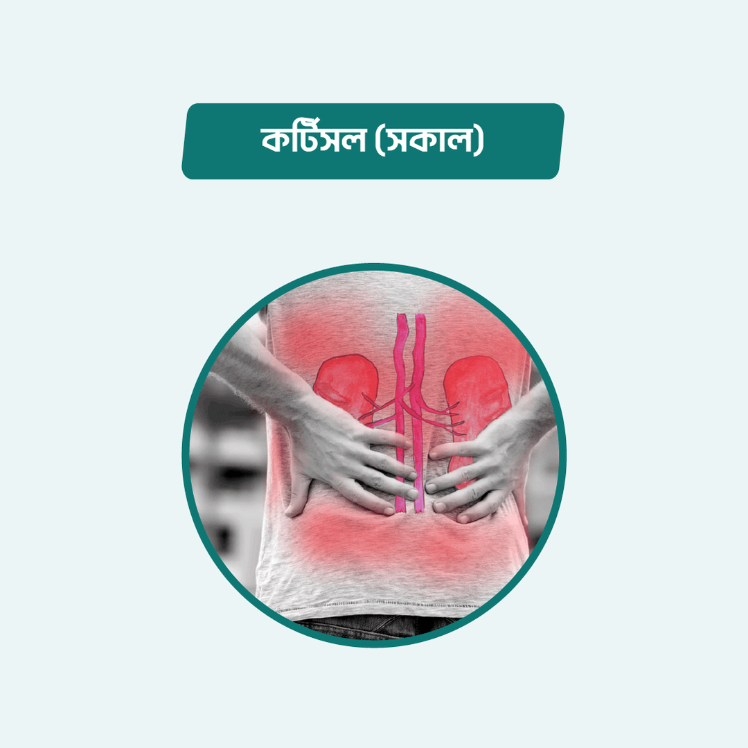 Cortisol (Morning)/BASAL CORTISOL (RANDOM) - Arogga Online Lab