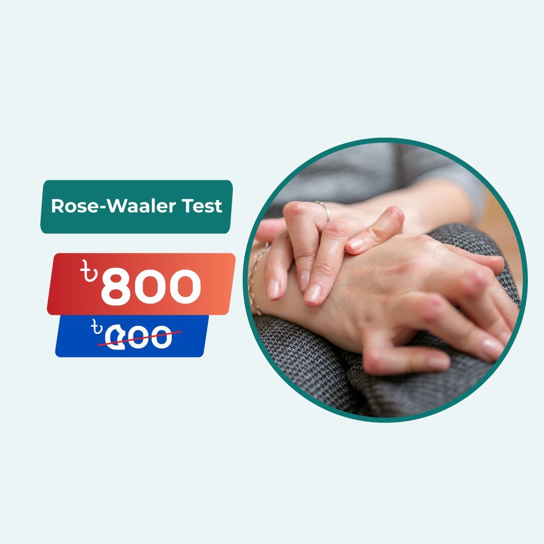 Rose-Waaler Test test Online in Dhaka | Arogga Online Lab