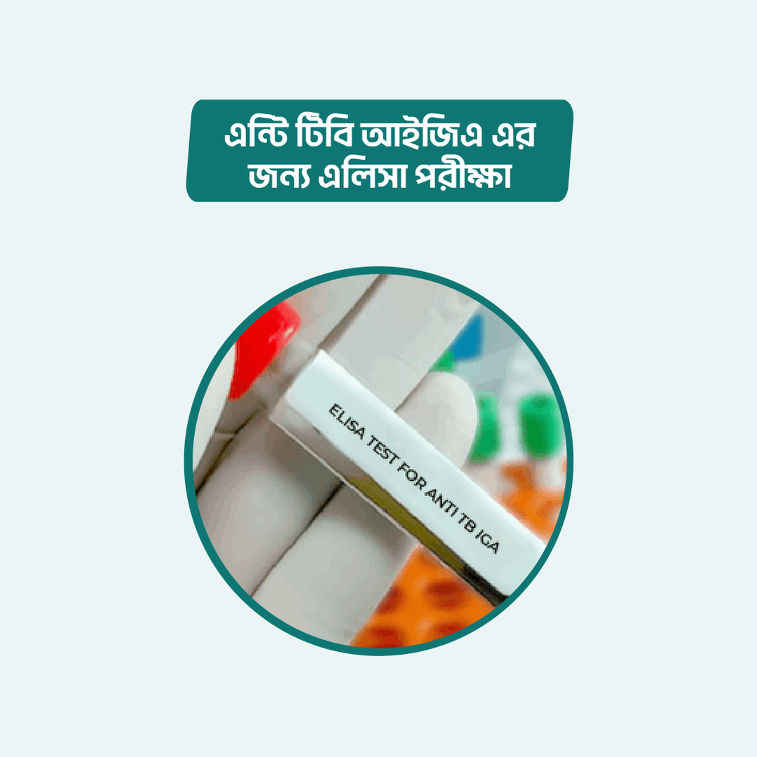 ELISA test for Anti TB IgA - Arogga Online Lab