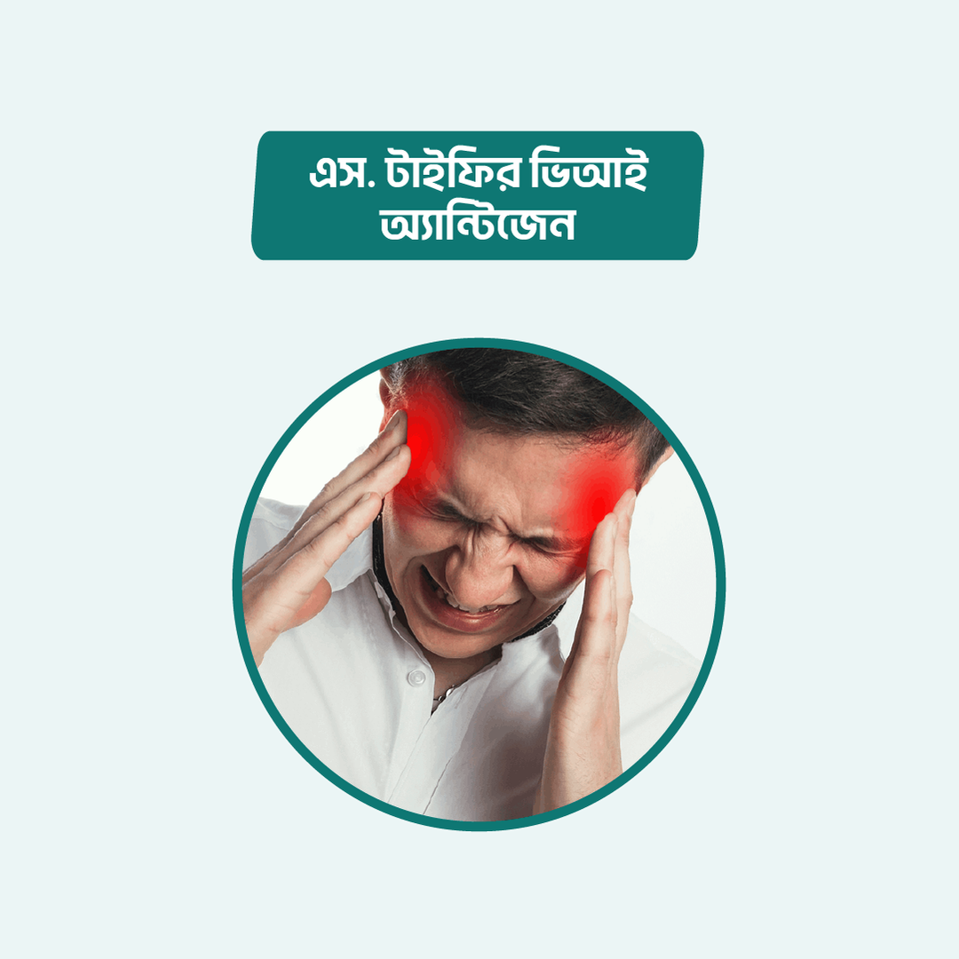 Vi Antigen of S. Typhi test Online in Dhaka | Arogga Online Lab