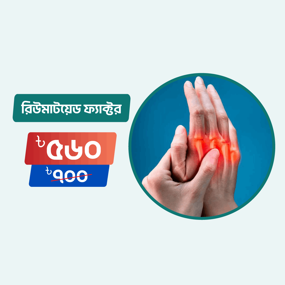 Rheumatoid Factor (RF) / (RA) - Arogga Online Lab