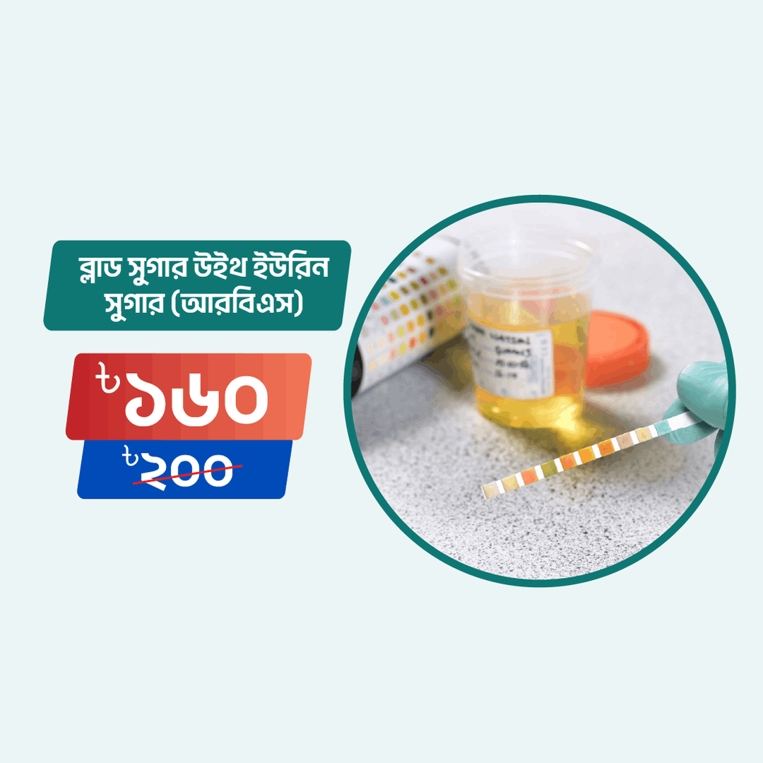 Glucose (RBS) with Corresponding Urine Sugar - Arogga Online Lab